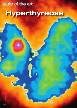 Definition: Als Hyperthyreose wird eine Überfunktion der