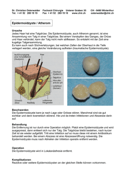 Epidermoidzyste / Atherom - Dr. Christian Osterwalder